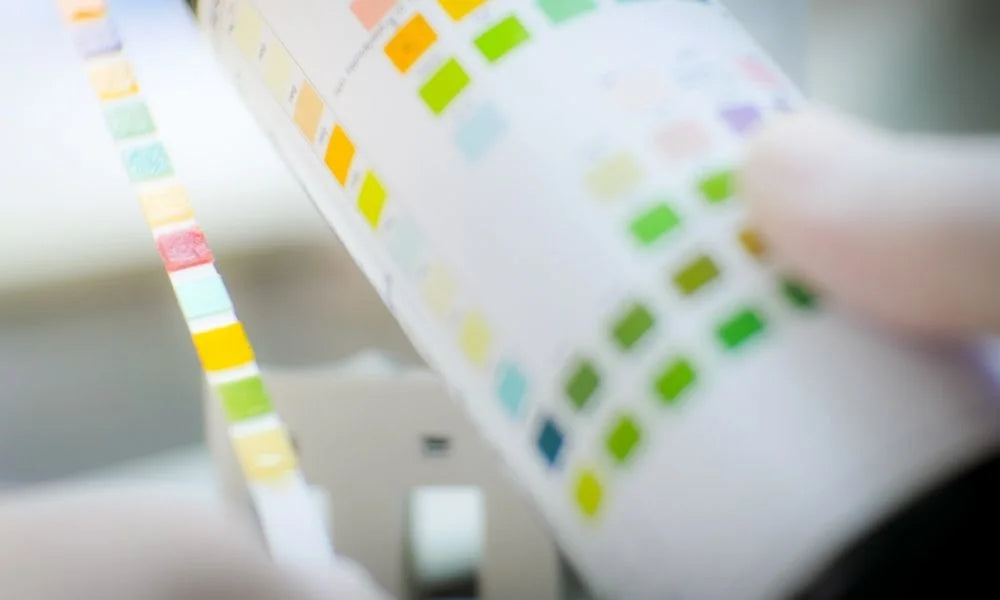 How To Read Urinalysis Test Strips - American Screening Corp