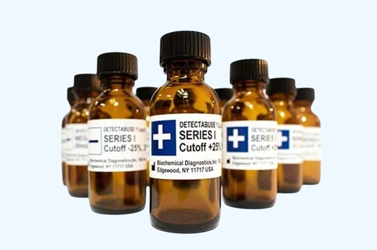 What Are Urine Controls and Why They Matter in Drug Testing Accuracy ...